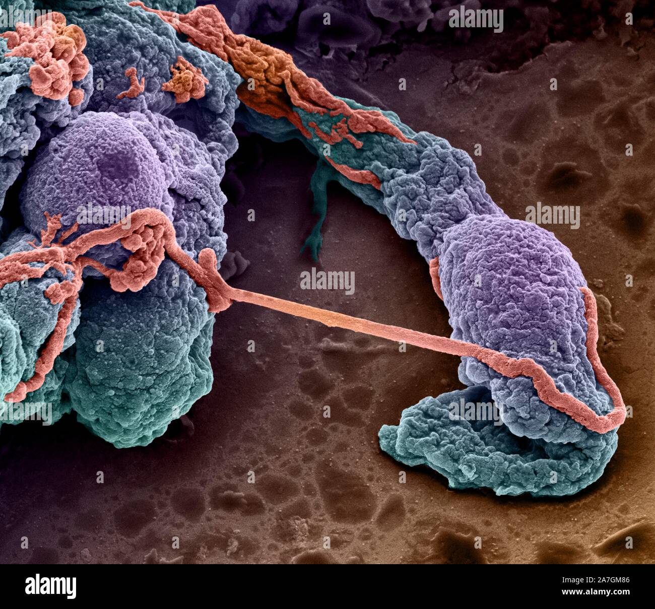 Cerebellum sem hi-res stock photography and images - Alamy