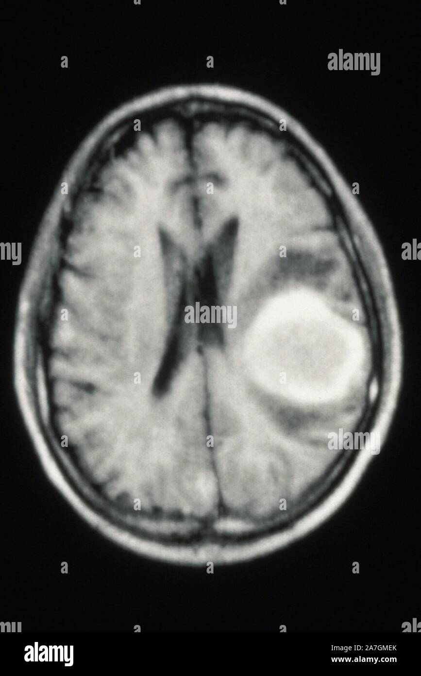 Brain function mri hi-res stock photography and images - Alamy