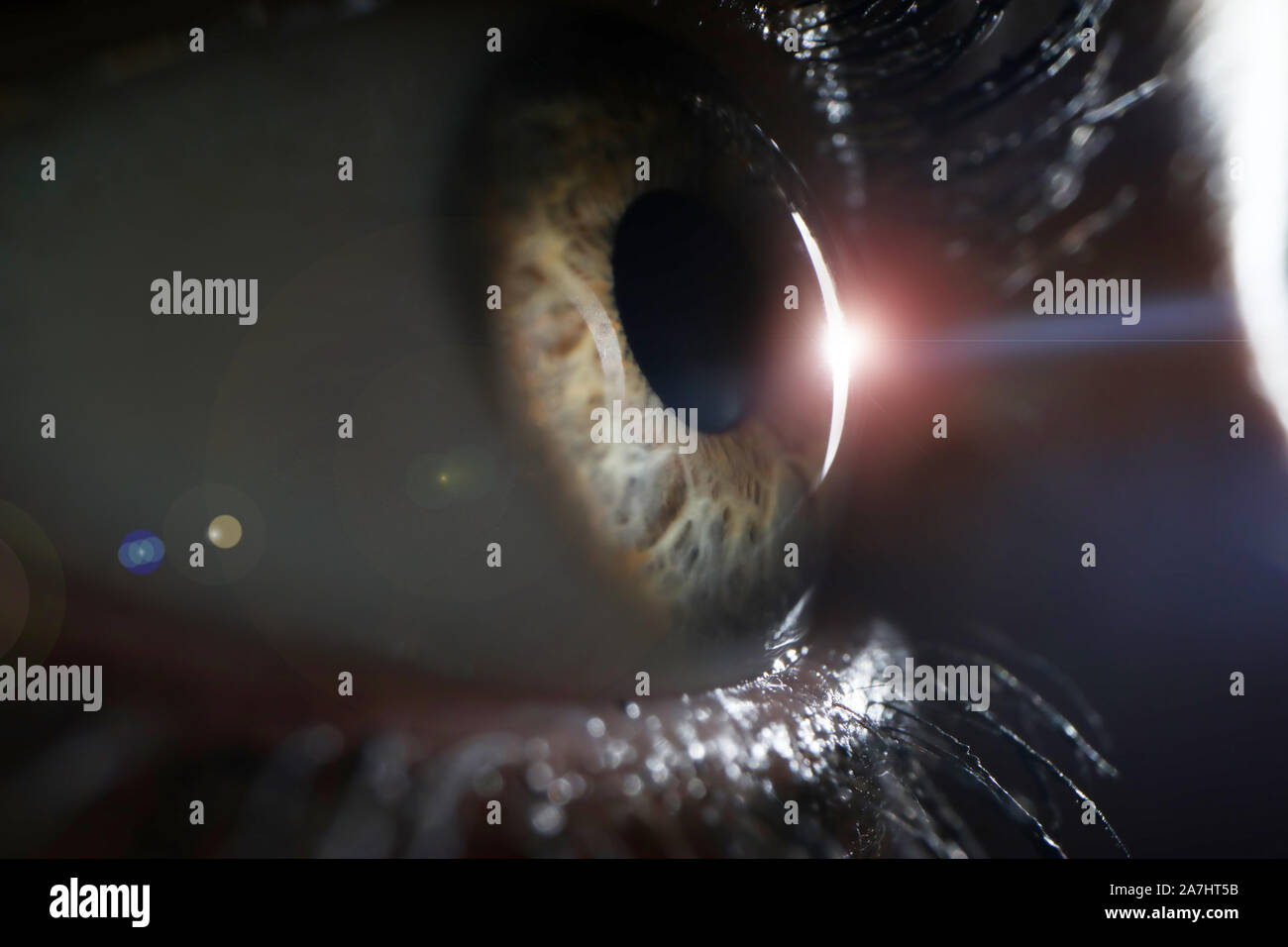 Fundus Of The Eye High Resolution Stock Photography and Images - Alamy