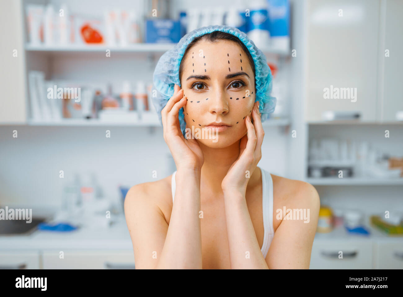 Patient with markers on face, preparation to botox Stock Photo - Alamy