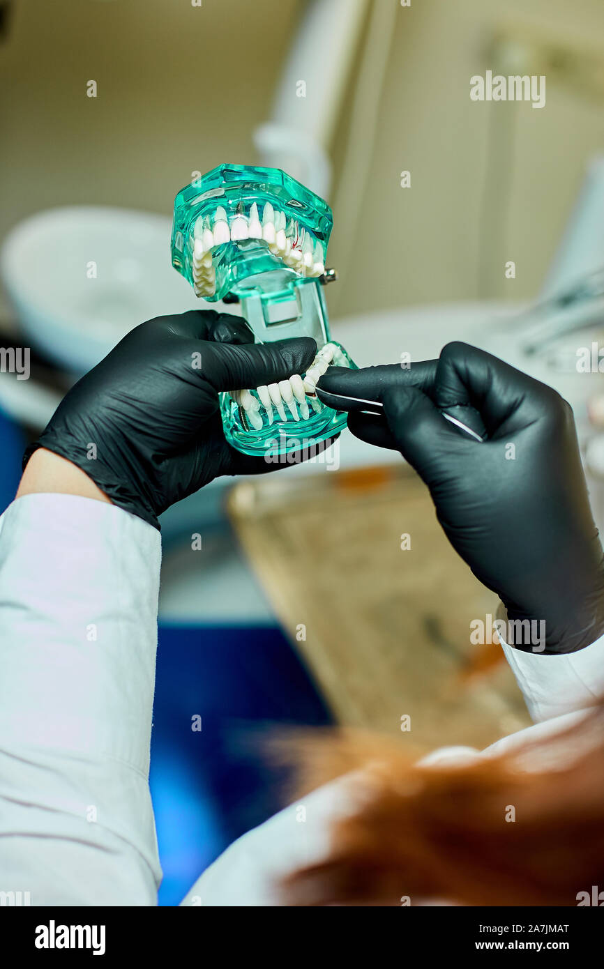 Dentist holding teeth model denture, showing with diagnostic ...