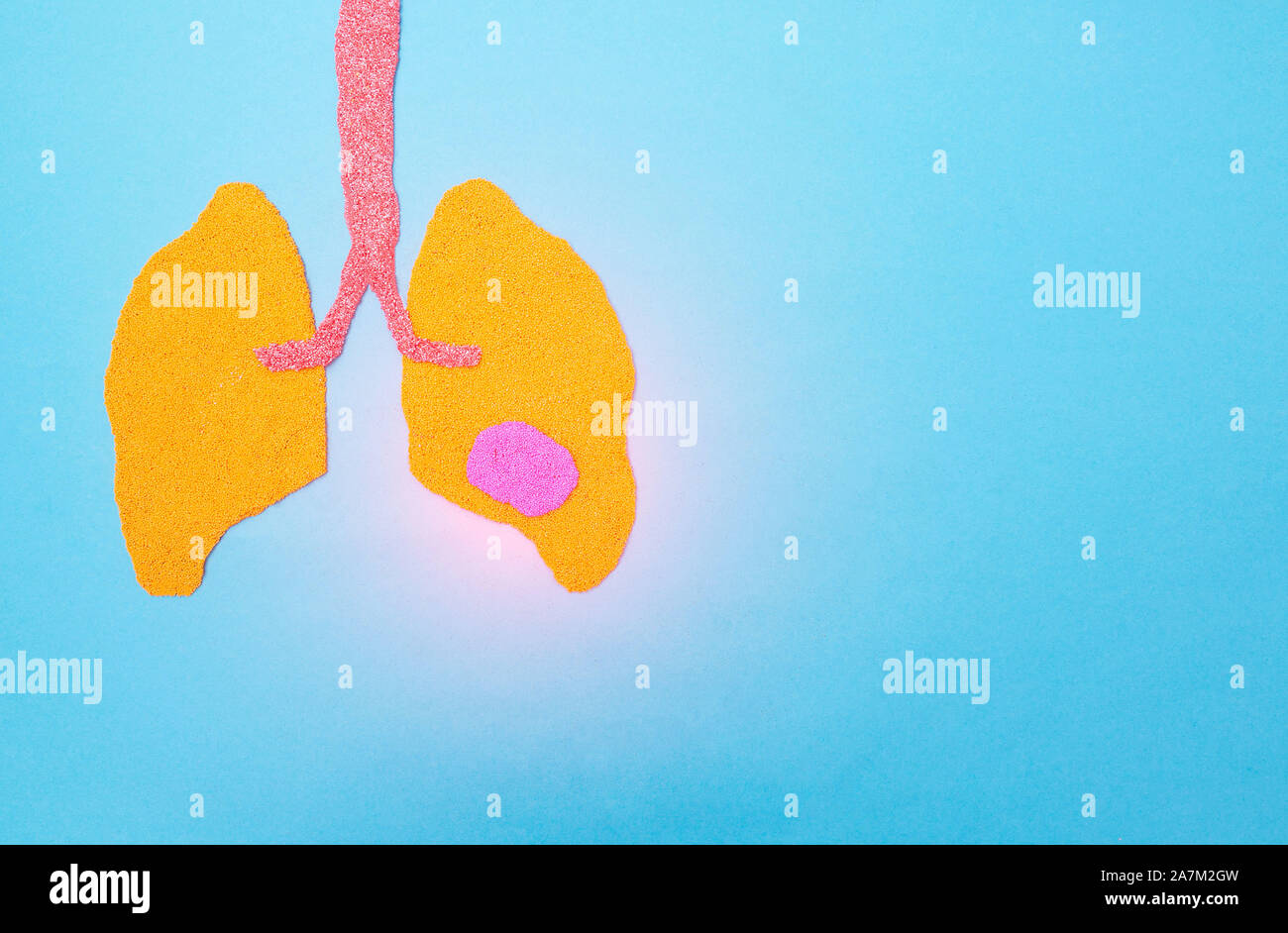 Human lungs on a blue background with a stain. Human lung disease ...