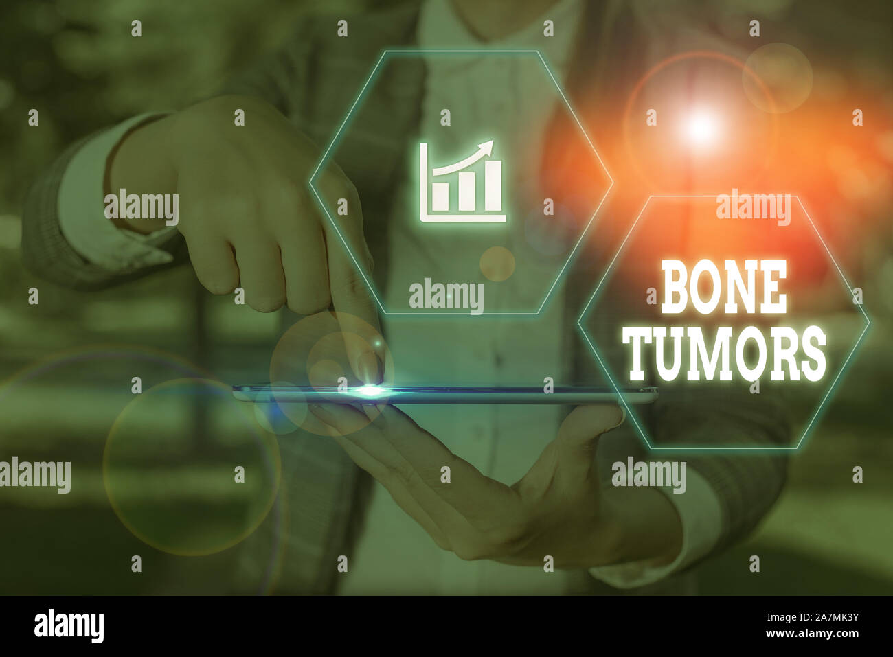 Word writing text Bone Tumors. Business photo showcasing can be either ...