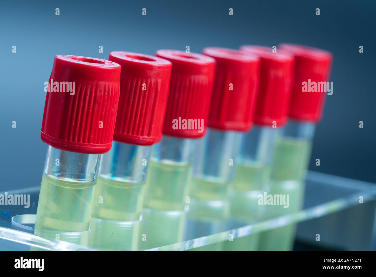 Test tubes with chemical samples in science laboratory Stock Photo - Alamy