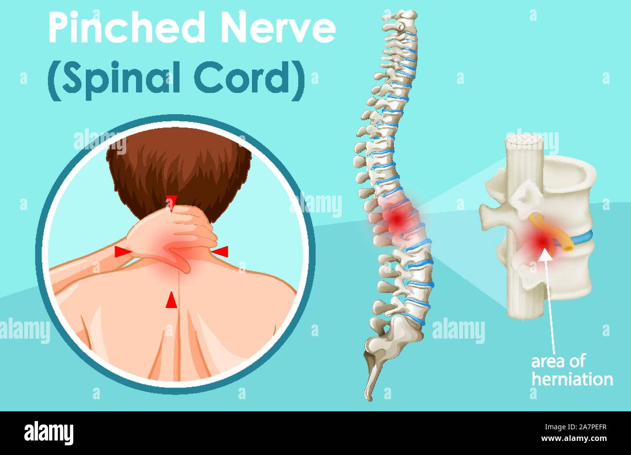 Diagram showing spinal cord illustration Stock Vector Image & Art - Alamy