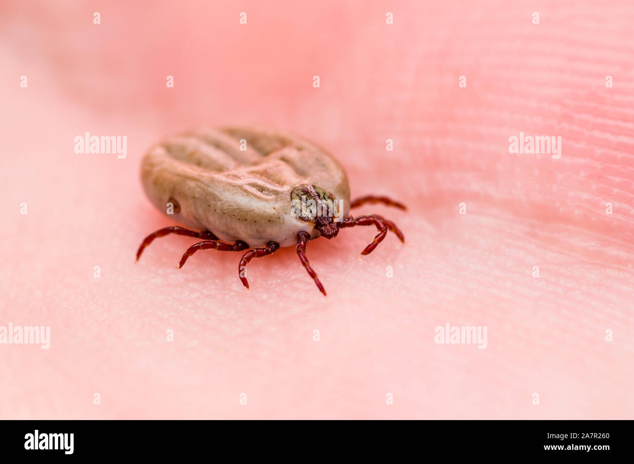 Encephalitis Virus or Lyme Borreliosis Disease Infectious Dermacentor ...
