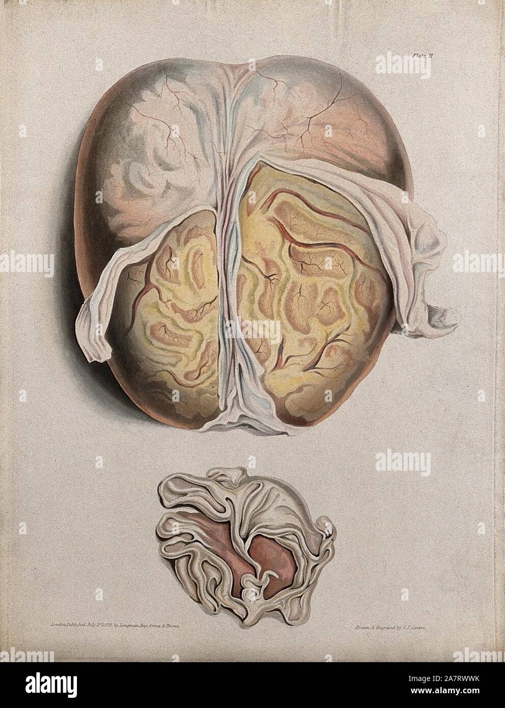Dissected human brain hi-res stock photography and images - Alamy