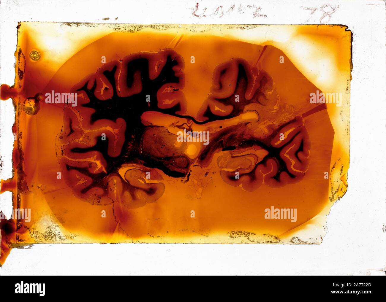 Antique medical illustration human brain hi-res stock photography and ...