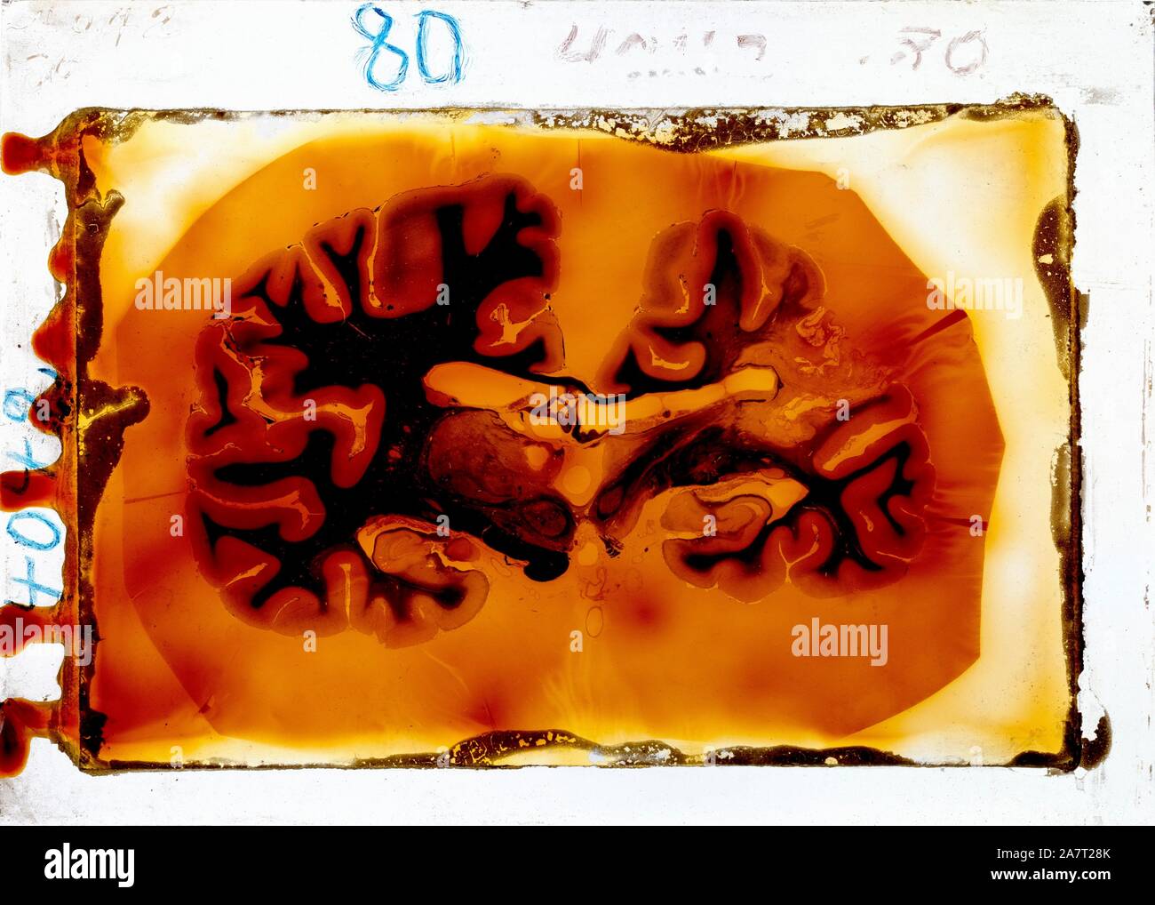 Antique medical illustration human brain hi-res stock photography and ...