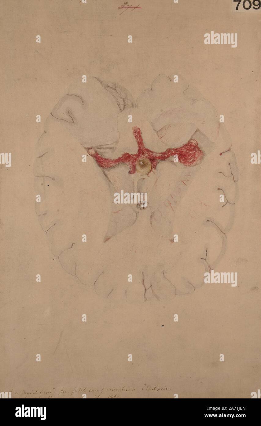 Pineal Gland Brain Anatomy High Resolution Stock Photography and Images ...