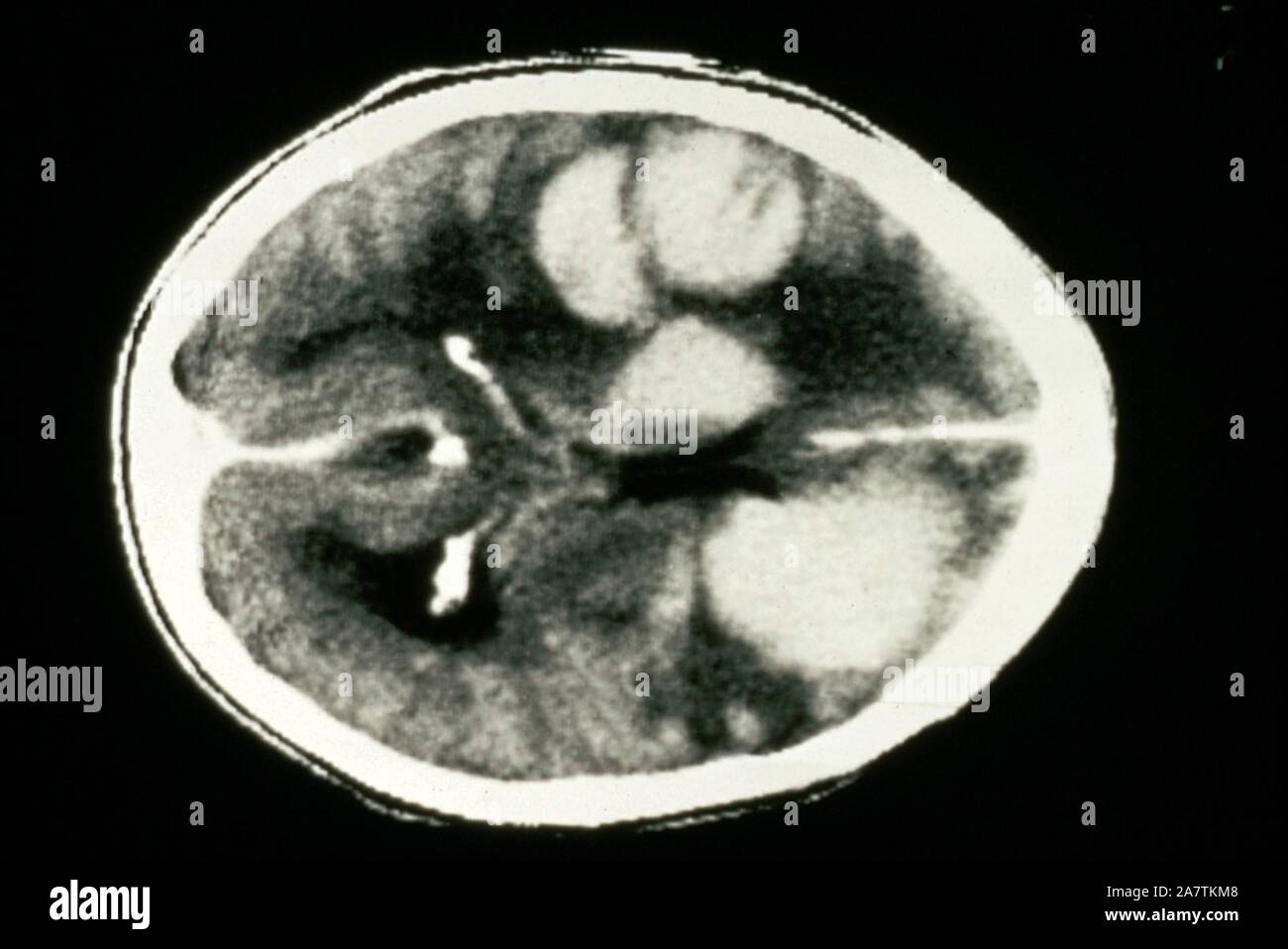 Primary cortex hi-res stock photography and images - Alamy