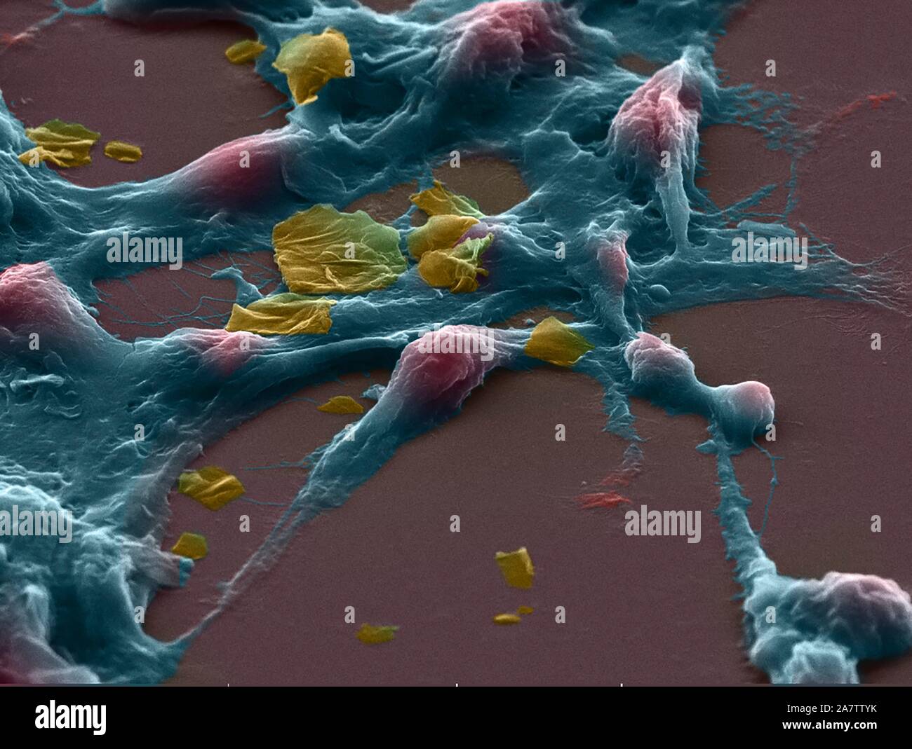 Brain cells sem hi-res stock photography and images - Alamy