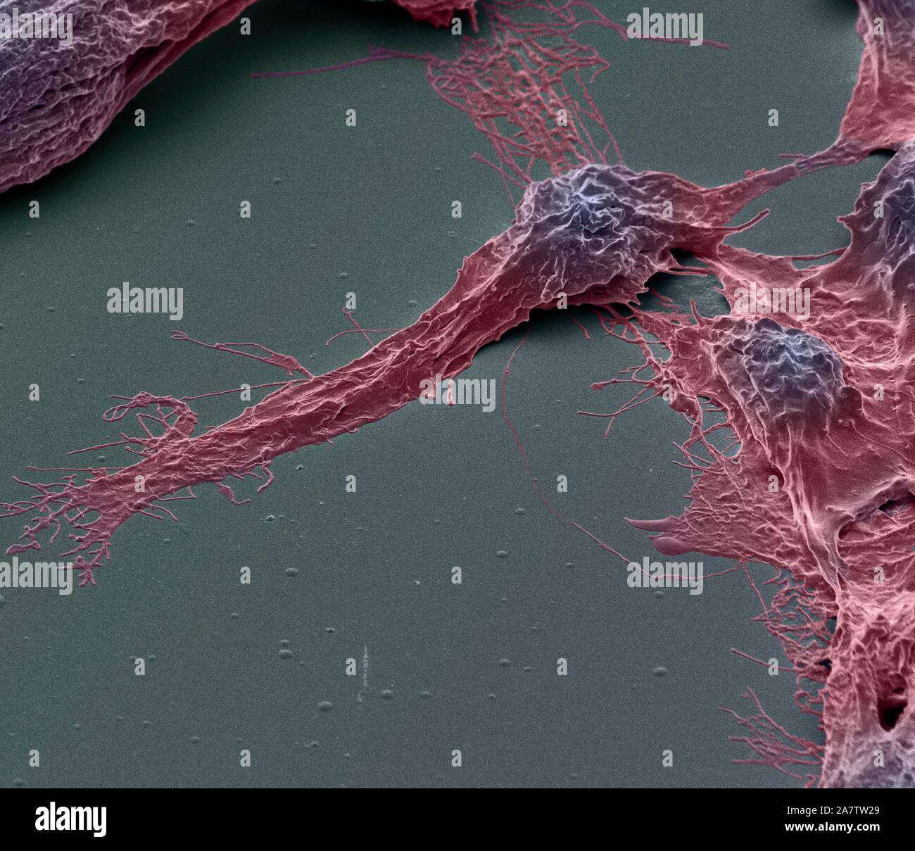 Brain cells sem hi-res stock photography and images - Alamy