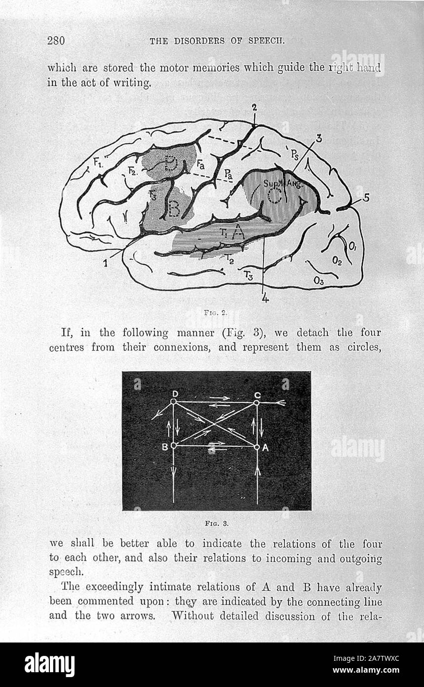 Cerebellum disorders hi-res stock photography and images - Alamy