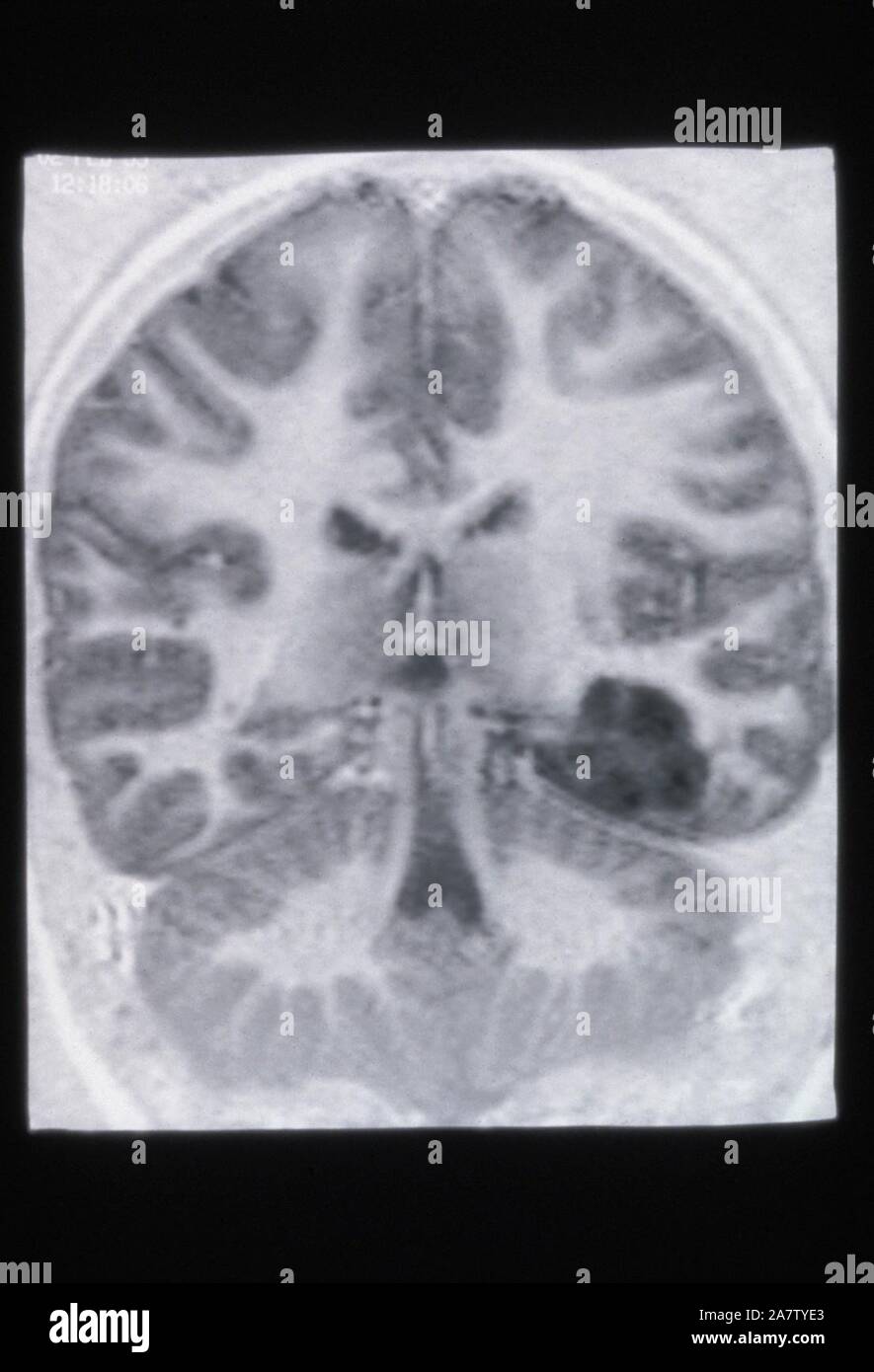 Primitive brain hi-res stock photography and images - Alamy