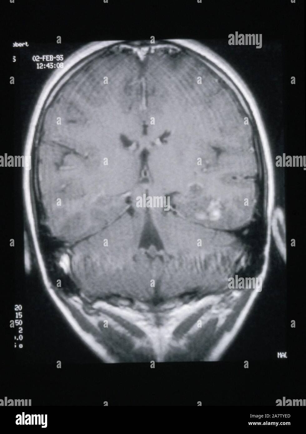 Primitive brain hi-res stock photography and images - Alamy