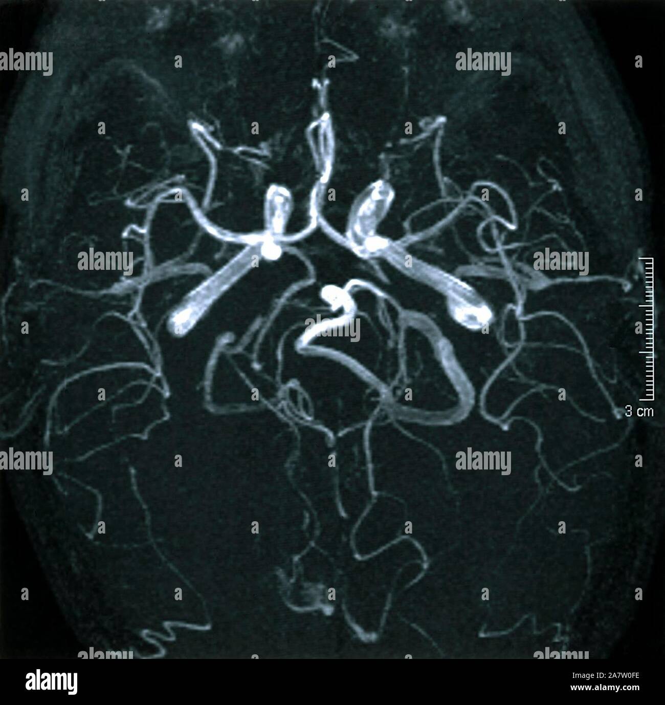 Normal human brain anatomy hi-res stock photography and images - Alamy