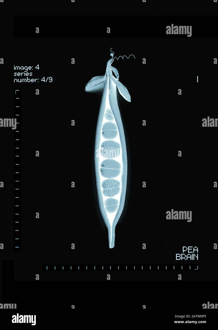 Pea Brain High Resolution Stock Photography and Images - Alamy