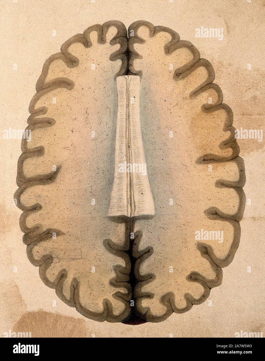 Cross Section Brain Corpus Callosum High Resolution Stock Photography ...