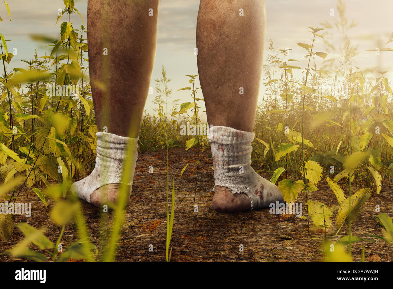 back of dirty and bloody feet with white socks and a big hole standing ...