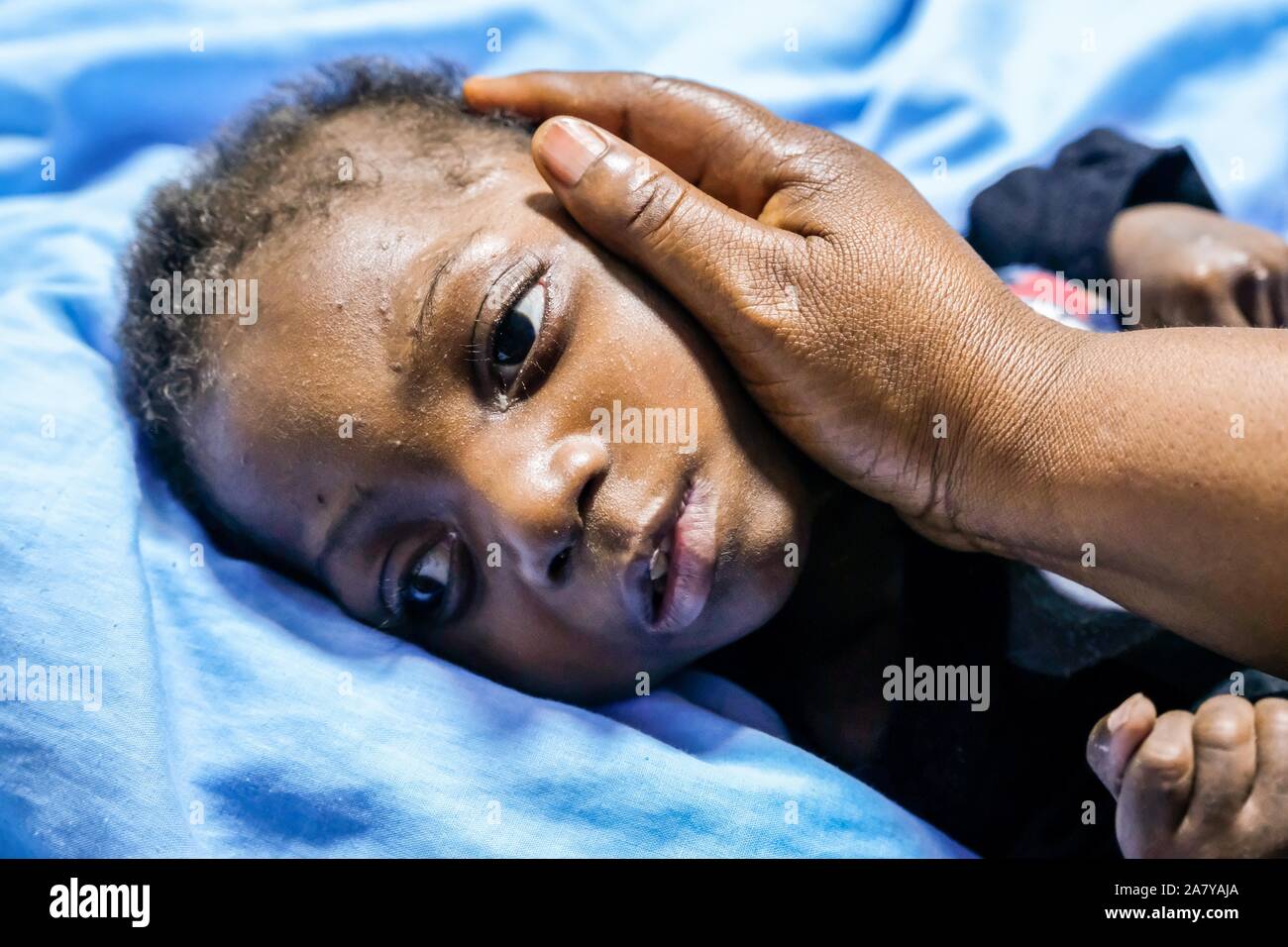 Malnourished Boy High Resolution Stock Photography and Images - Alamy