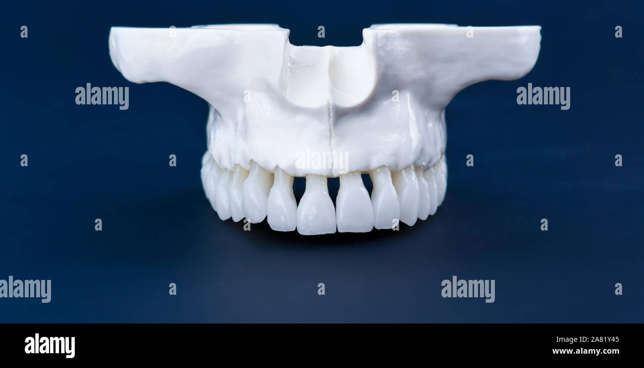Upper human jaw with teeth anatomy model medical illustration isolated ...