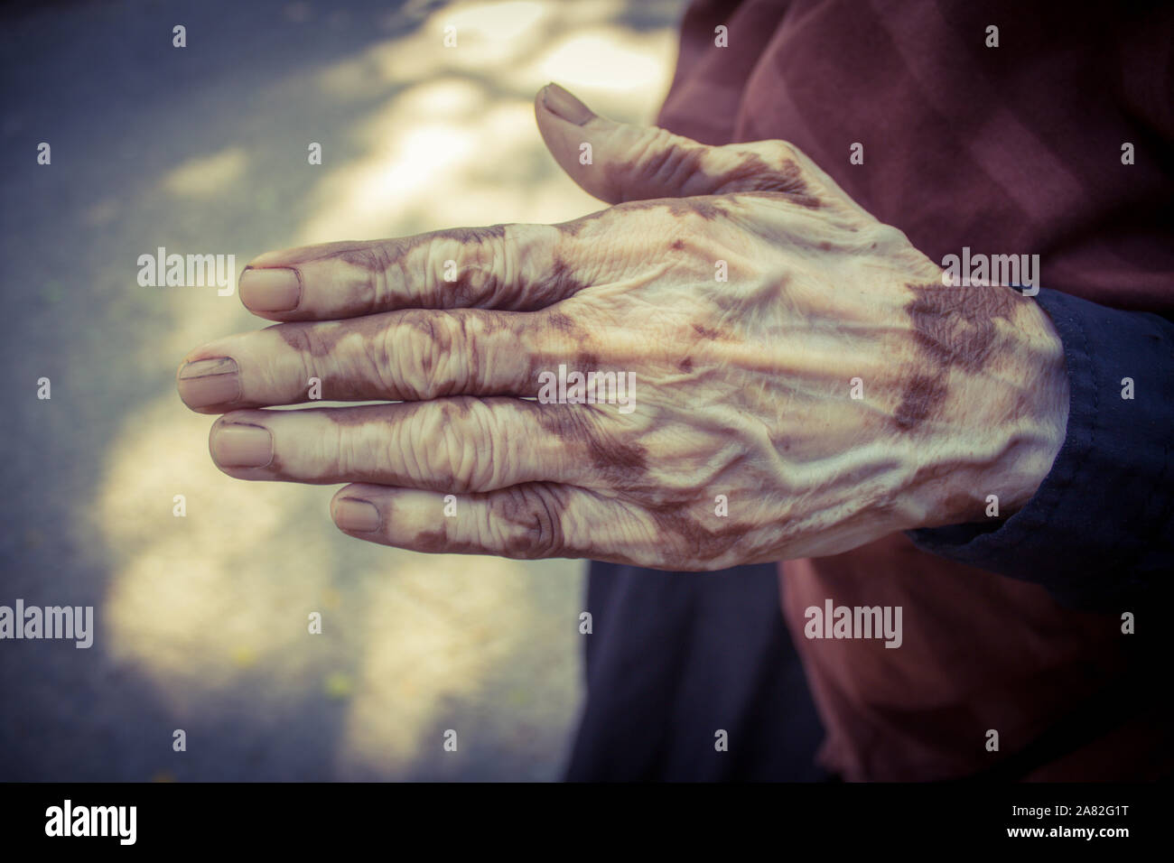 Vitiation High Resolution Stock Photography and Images - Alamy
