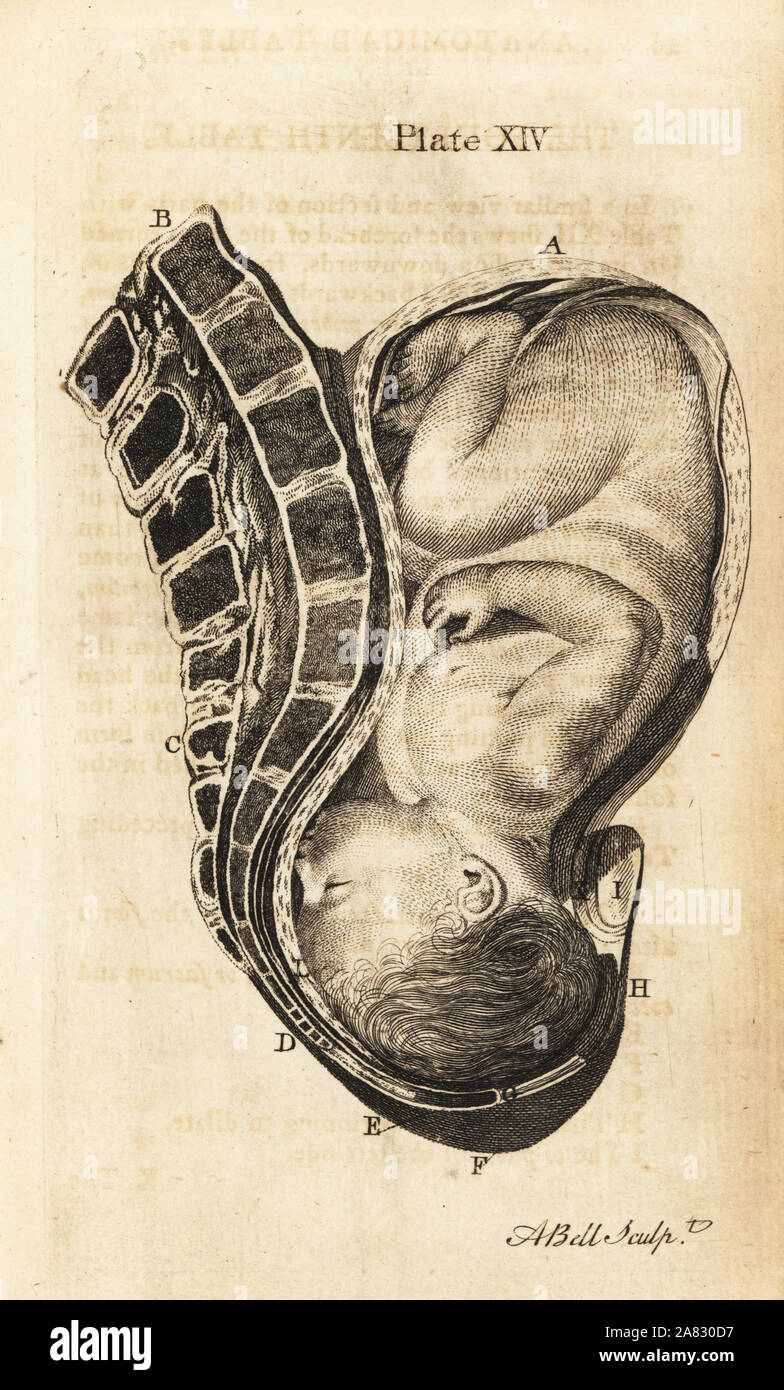 Lateral view of the foetus head sunk down in the pelvis during advanced ...
