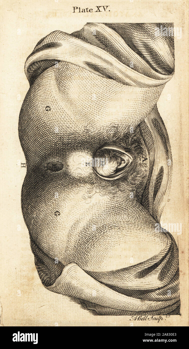Perineum and external parts stretched by the foetus head during late ...