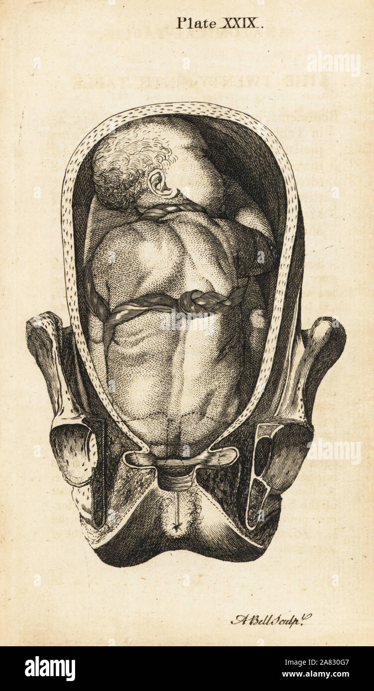 Breech position hi-res stock photography and images - Alamy