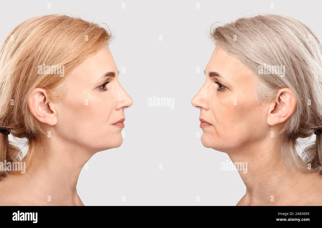 Comparison portrait of middle-aged woman on light background. Process ...