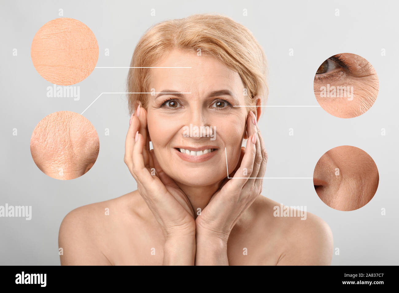 Beautiful mature woman with skin problem on light background. Process ...