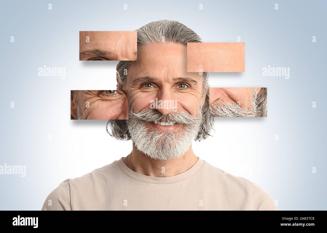 Portrait of mature man with skin problem on light background. Process ...