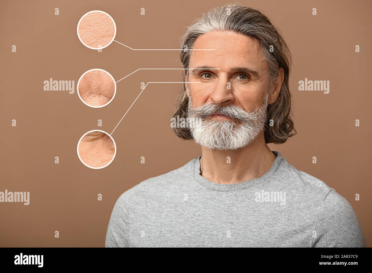 Portrait of mature man with skin problem on color background. Process ...