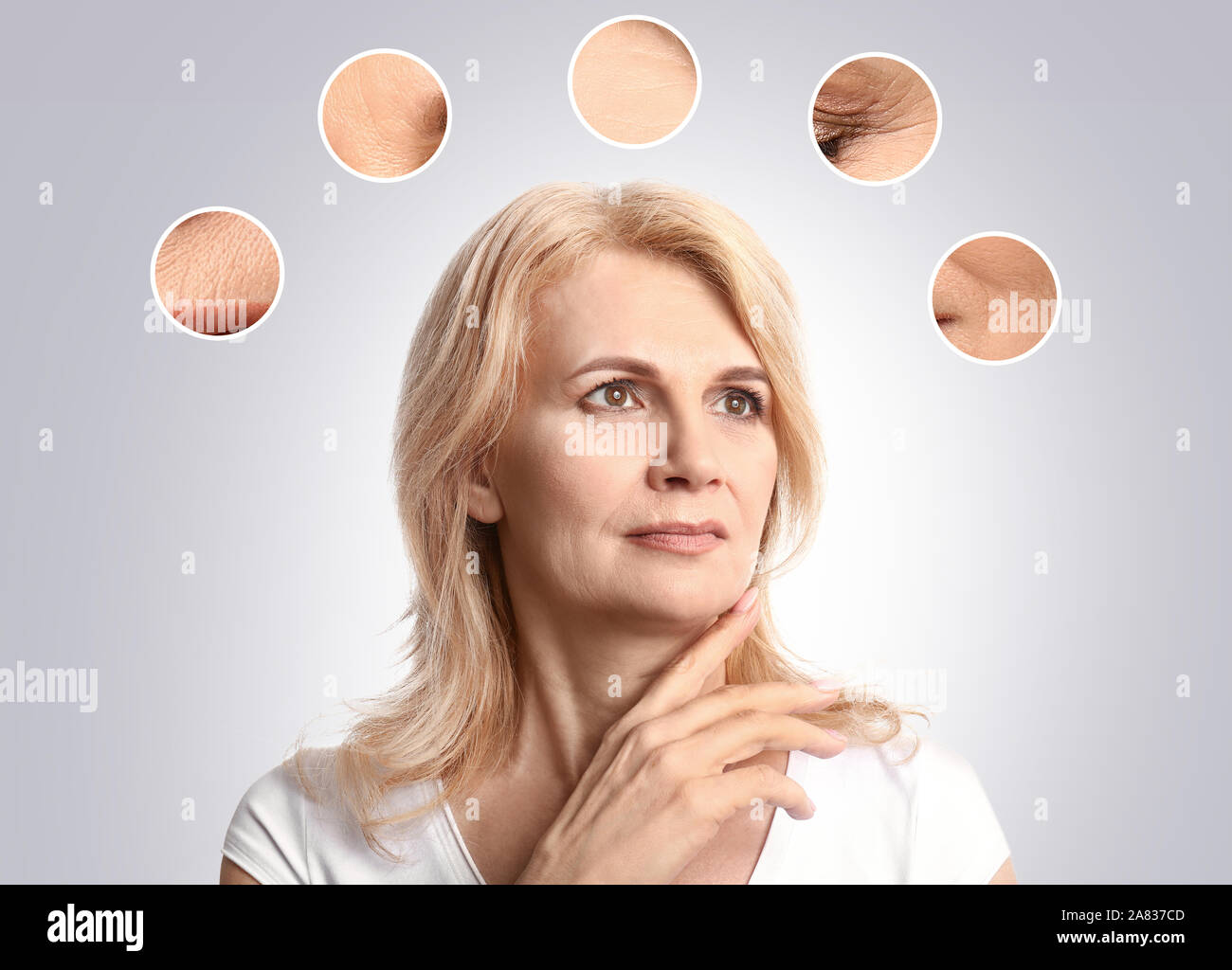 Portrait of beautiful mature woman with skin problem on light ...