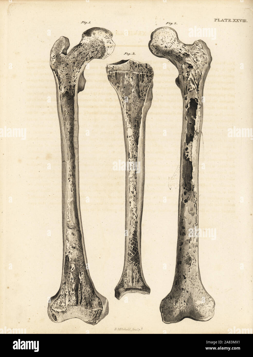 Longitudinal section tibia hi-res stock photography and images - Alamy