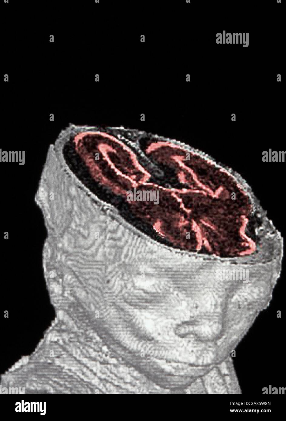 Foetal scan hi-res stock photography and images - Alamy