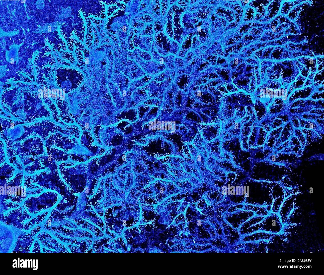 Dendritic cell sem hi-res stock photography and images - Alamy
