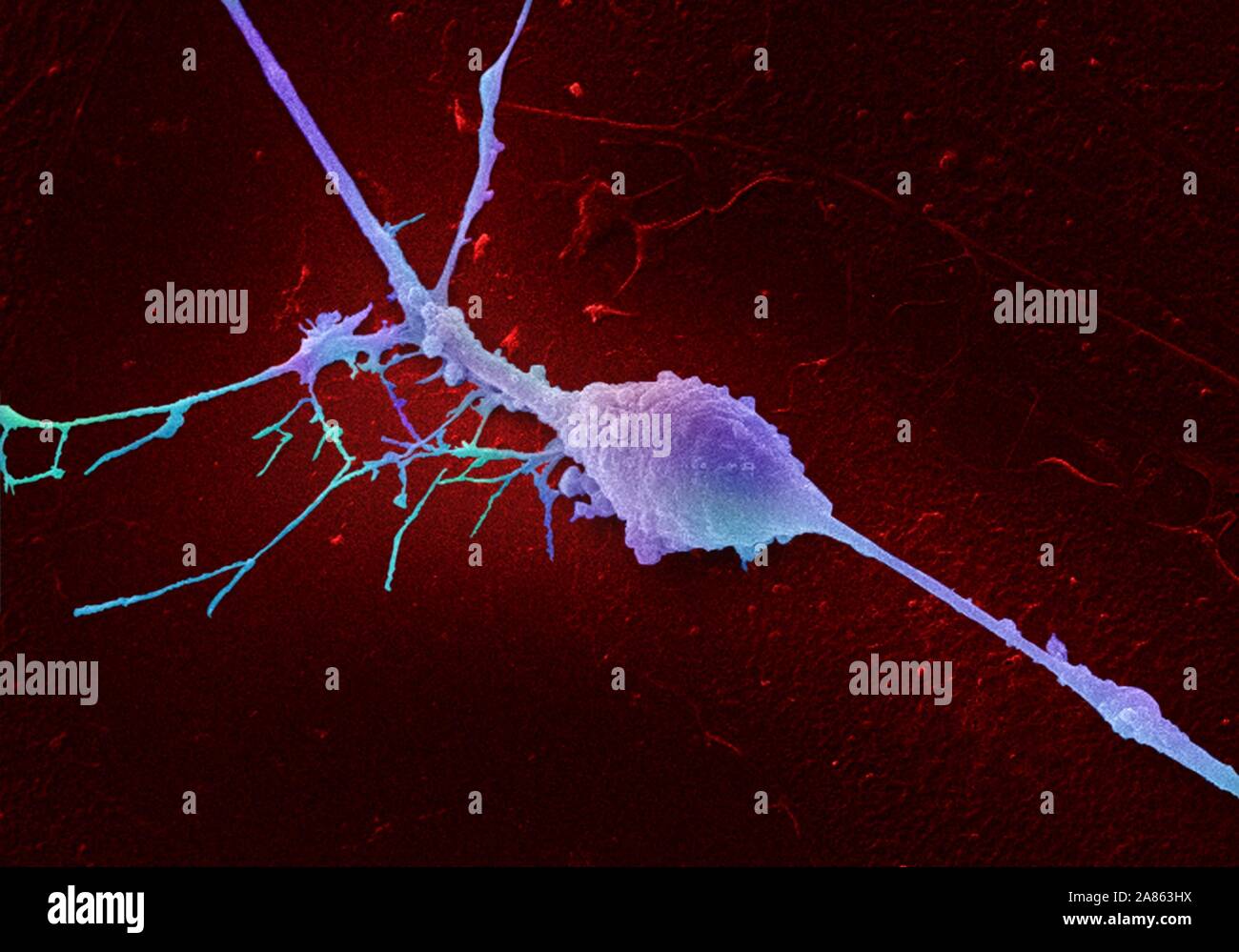 Retinal ganglion cell hi-res stock photography and images - Alamy