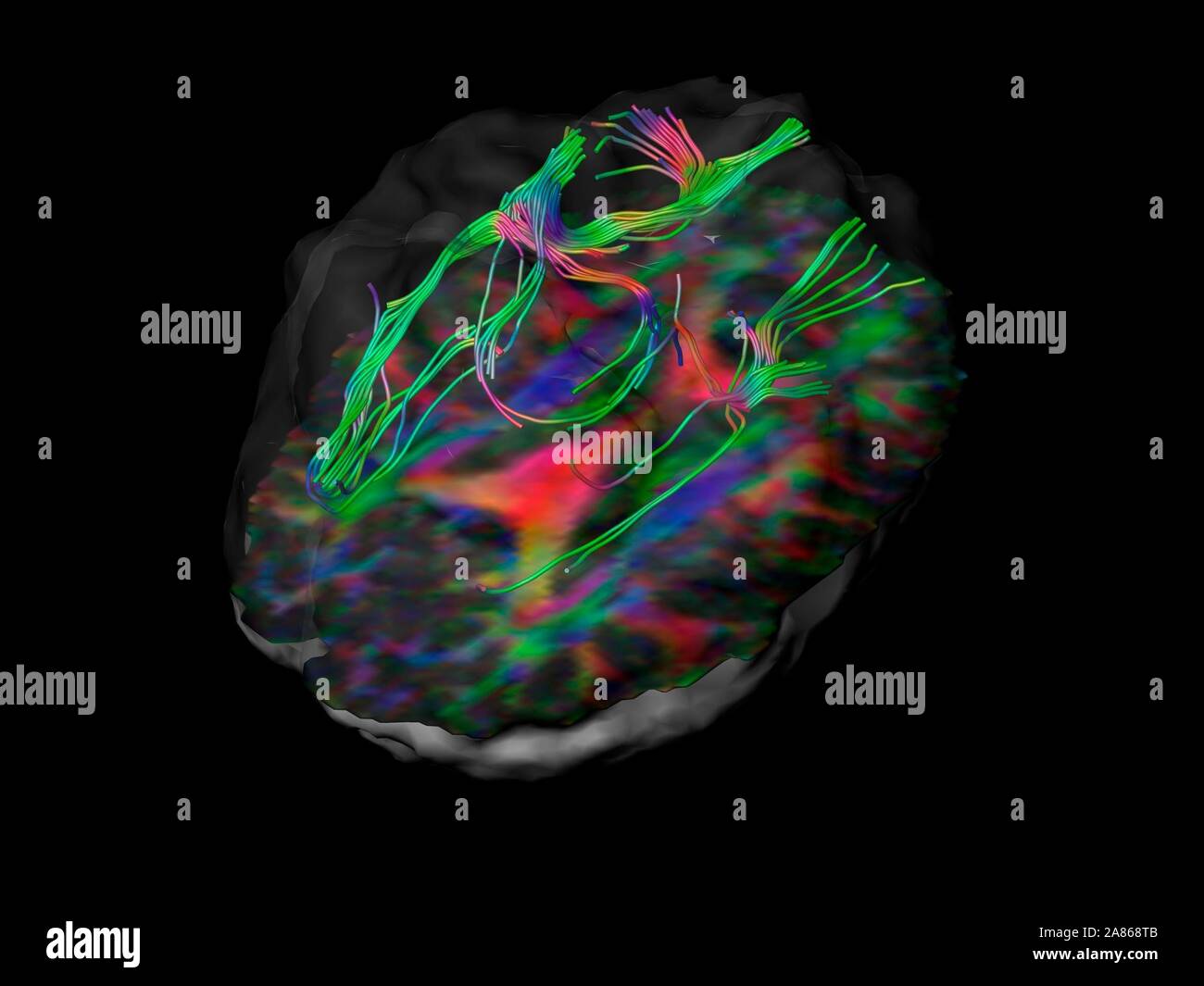 Uncinate fasciculus hi-res stock photography and images - Alamy
