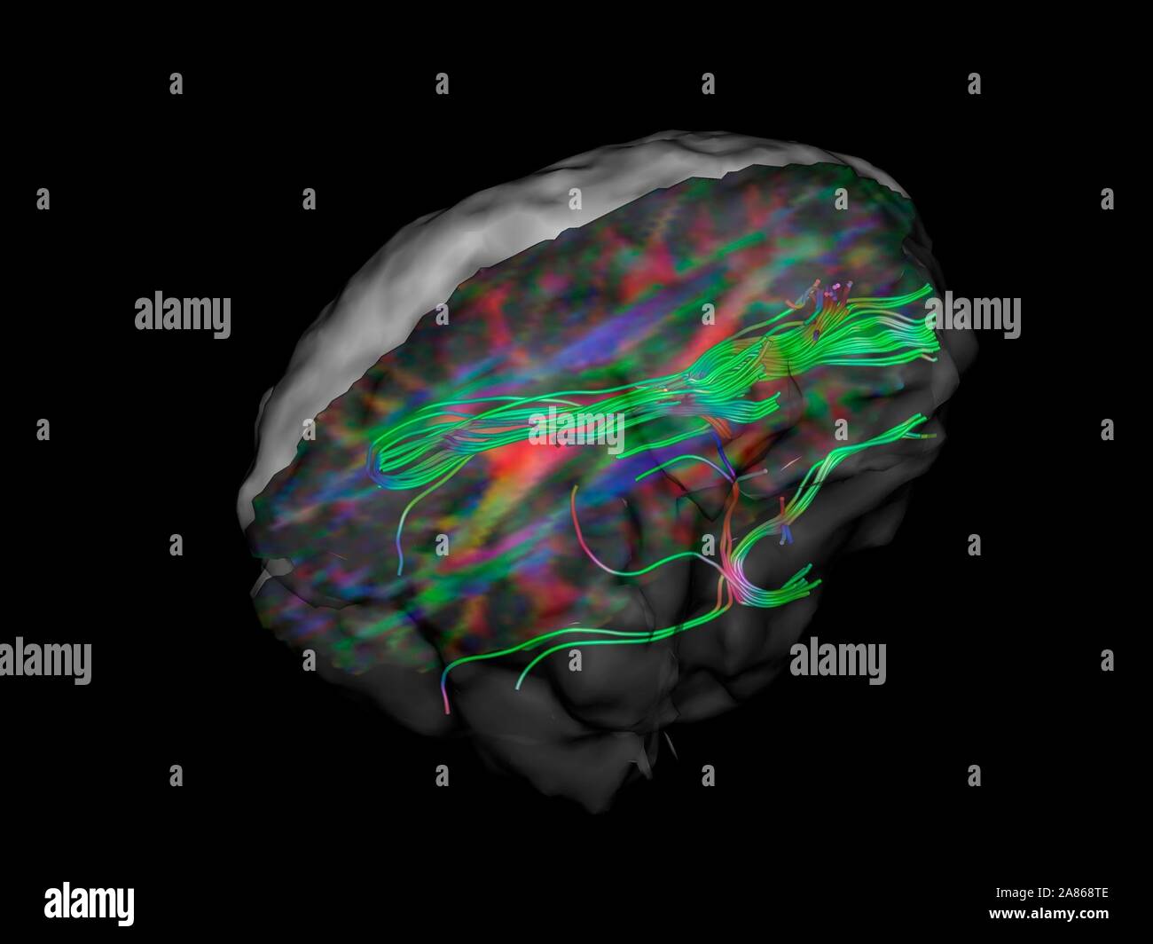 Uncinate fasciculus hi-res stock photography and images - Alamy