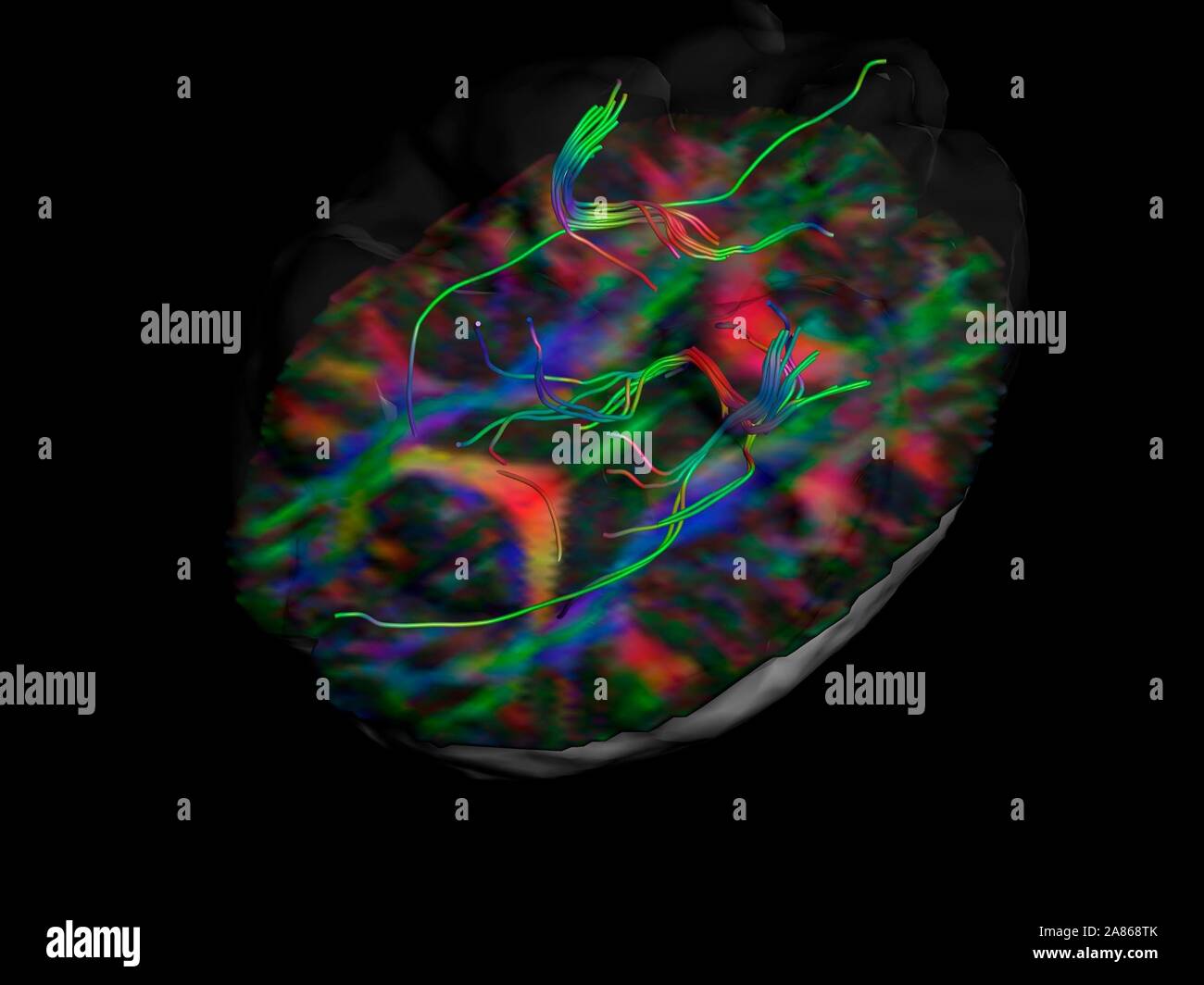 White Matter Fibres Of The Human Brain High Resolution Stock ...