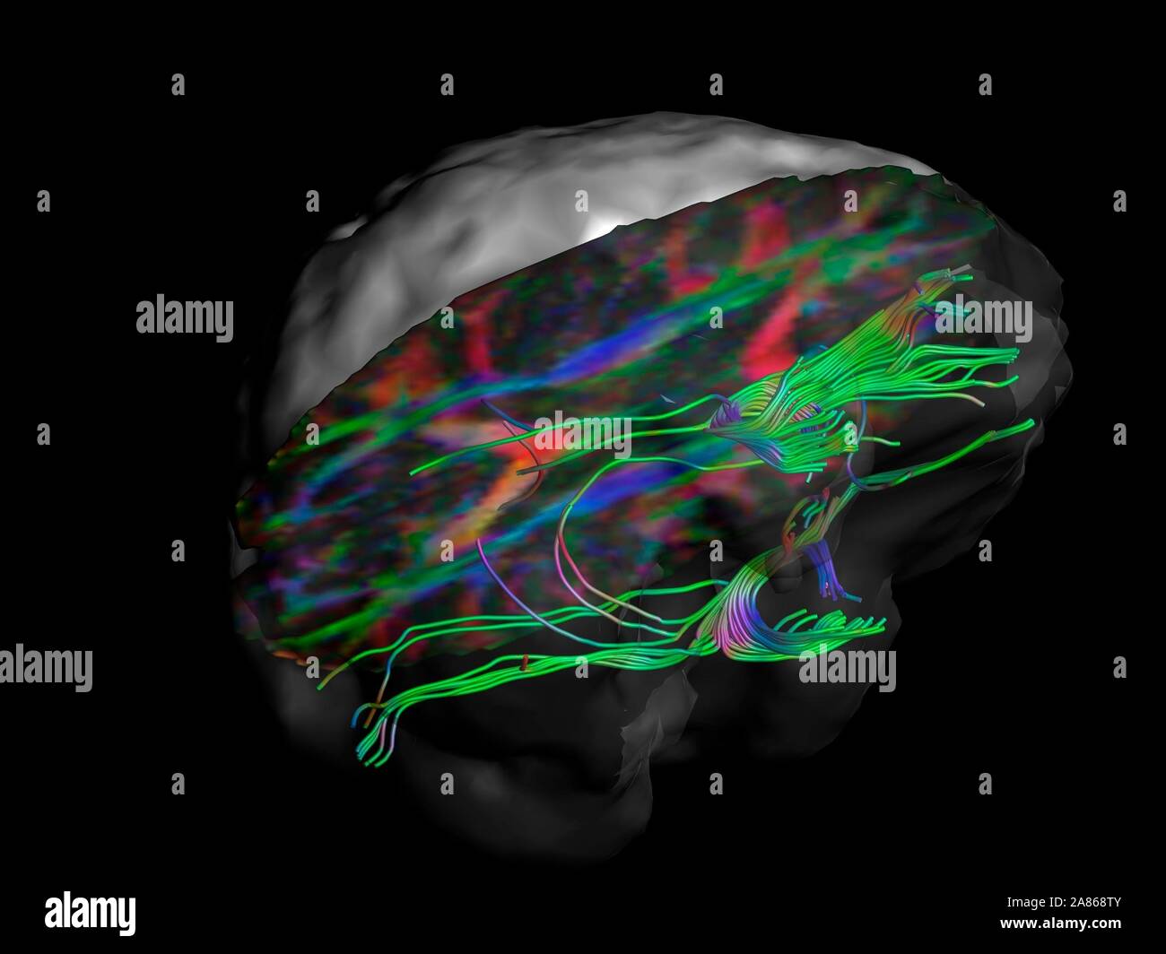 White Matter Fibres Of The Human Brain High Resolution Stock ...