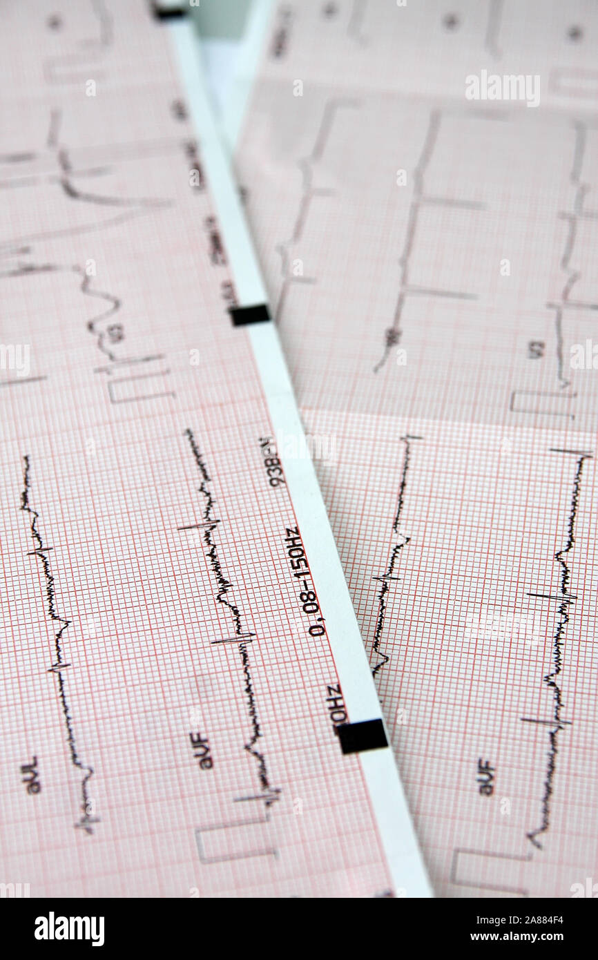 Ecg analysis hi-res stock photography and images - Alamy