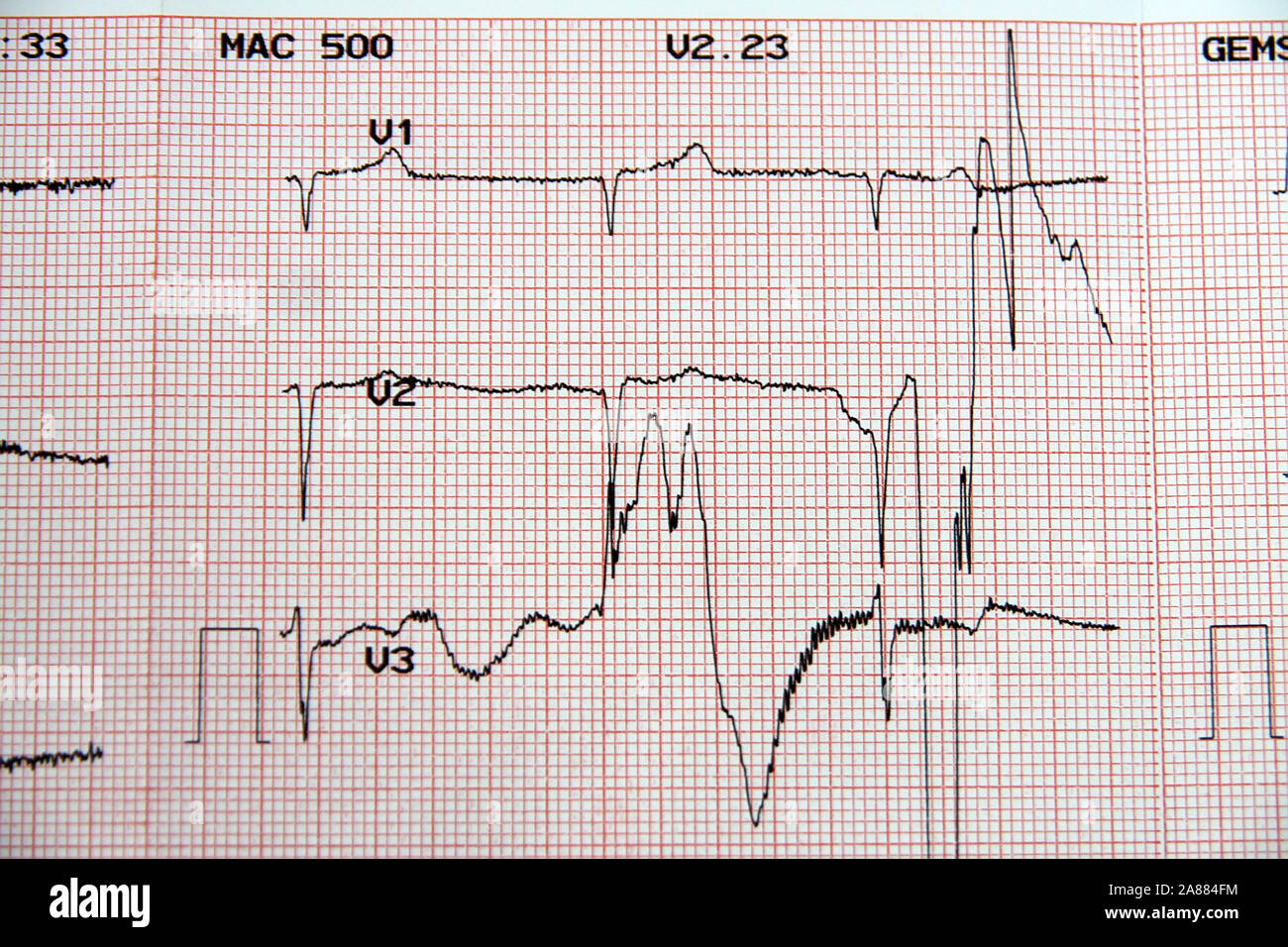 Ecg analysis hi-res stock photography and images - Alamy