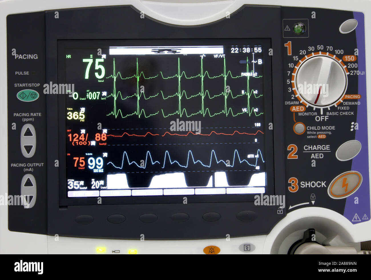 Ekg monitor hi-res stock photography and images - Alamy