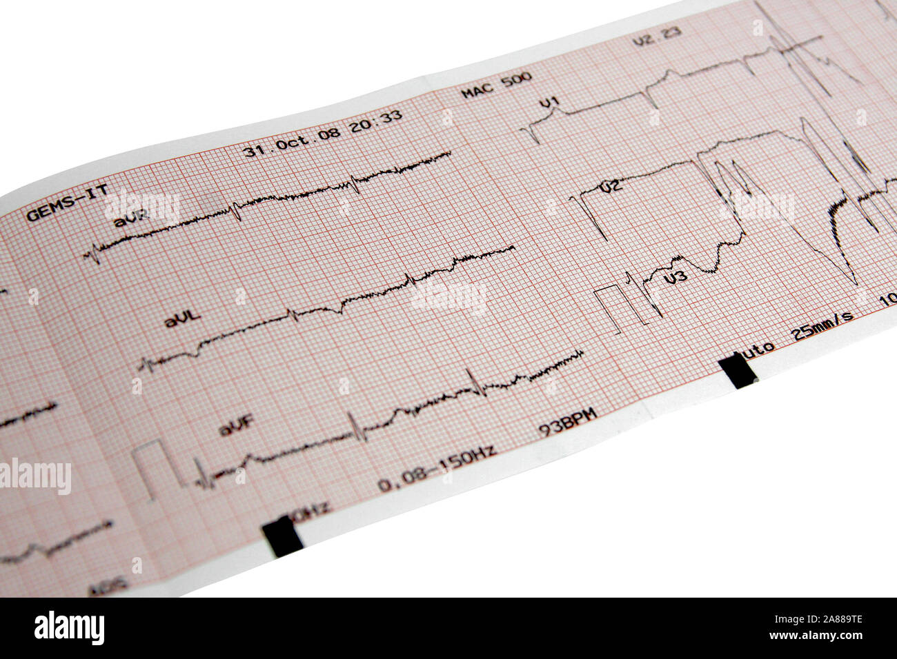 Electrocardiogram machine hi-res stock photography and images - Alamy
