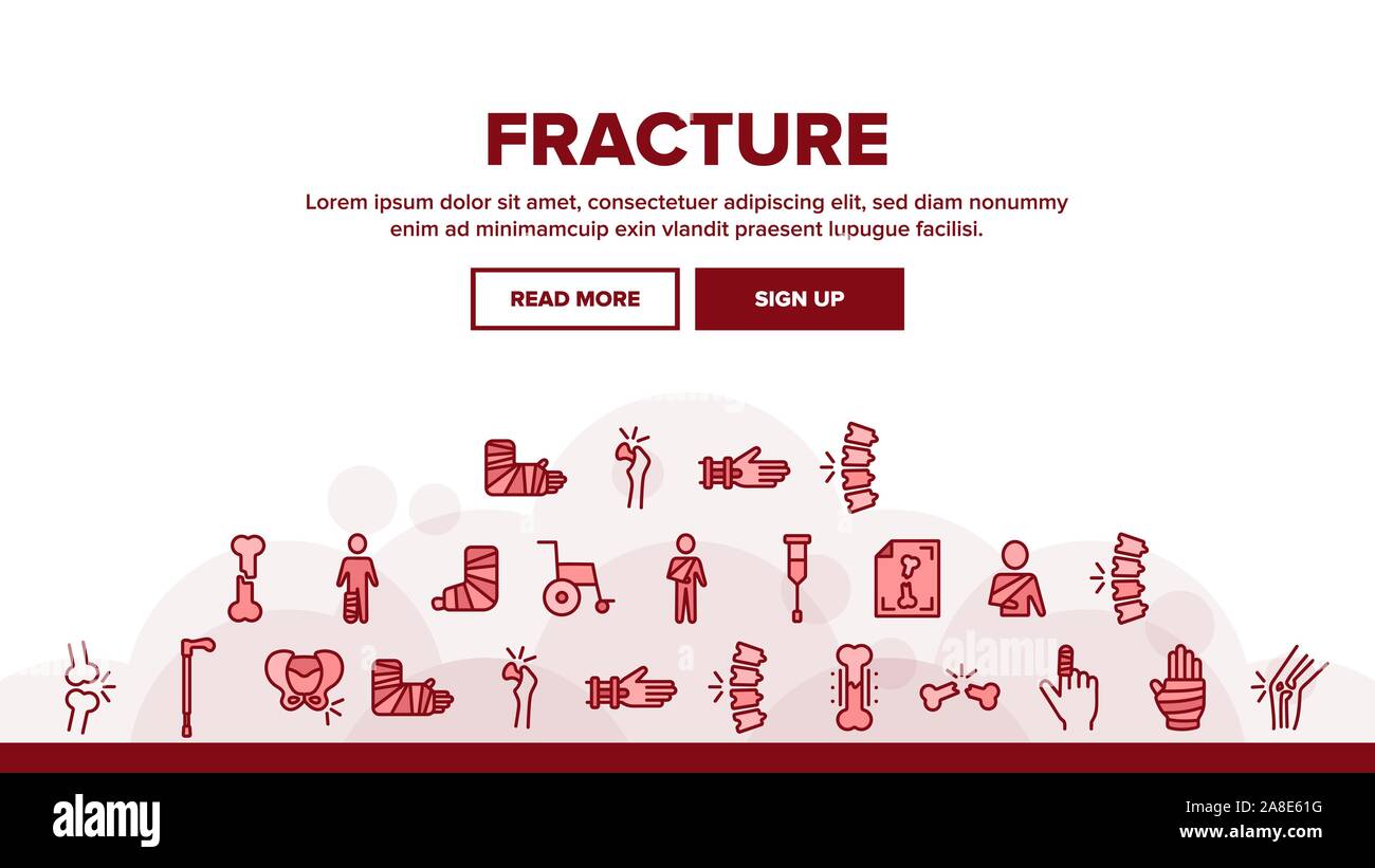 Collection Fracture Elements Vector Sign Icons Set Stock Vector Image ...