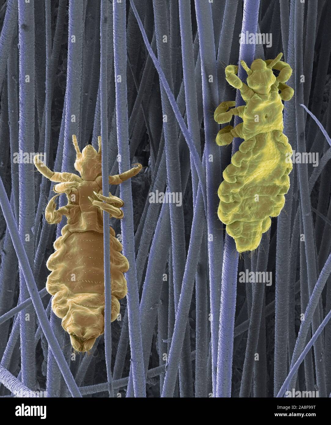 Head lice, SEM Stock Photo - Alamy