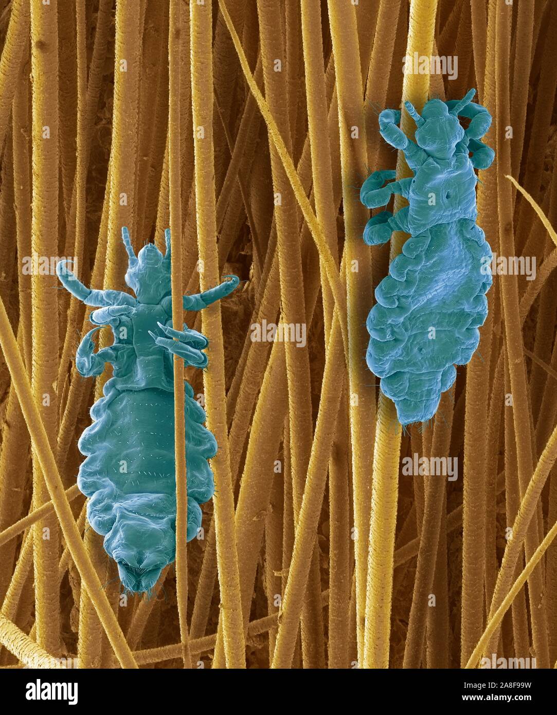 Head lice, SEM Stock Photo - Alamy